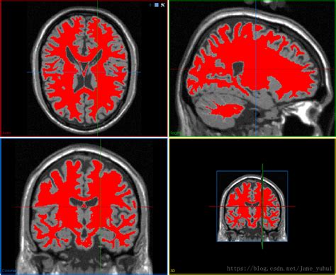 Itk 区域增长 （用于分割）itk分割 Csdn博客
