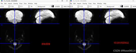 基于dpabi和spm12的脑脊液(csf)分割和提取笔记spm12分割 Csdn博客 基于dpabi和spm12的脑脊液(csf)分割和提取笔记spm12分割 Csdn博客