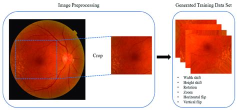 Image Preprocessing Eye Images Were Preprocessed By Keras Download Scientific Diagram
