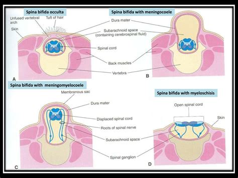 Ppt Development Of Vertebral Column And Spinal Cord Powerpoint