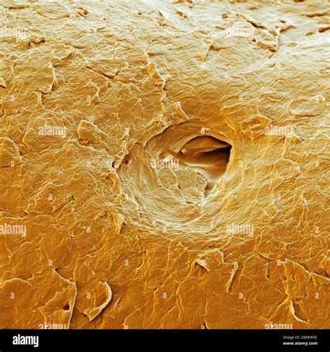 Sweat Pore Coloured Scanning Electron Micrograph Sem Of A Sweat Pore Centre On A Human Hand