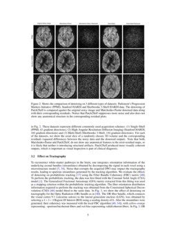 Patch Self Denoising Diffusion MRI With Self Supervised Learning DeepAI