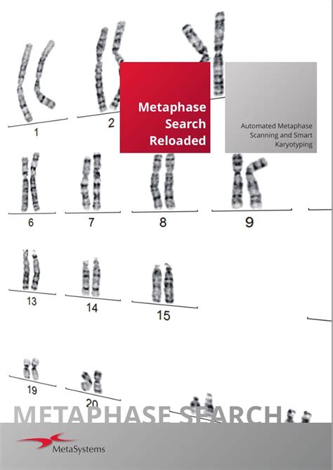 Ikaros Karyotyping System Metasystems