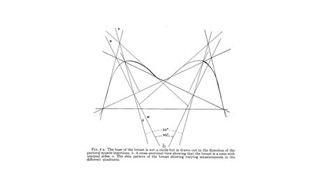 A Step By Step Approach To A Successful Cosmetic Breast Reduction Prs