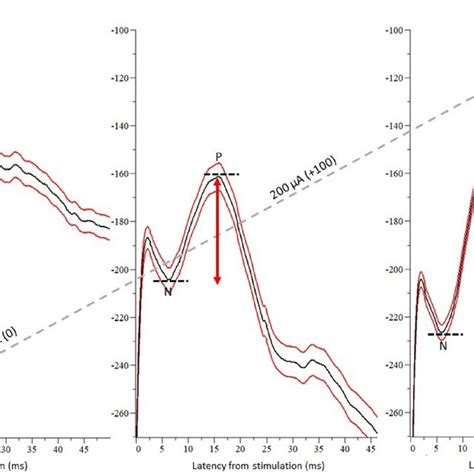 A Schematic Representation Of The Ipsilateral And Contralateral