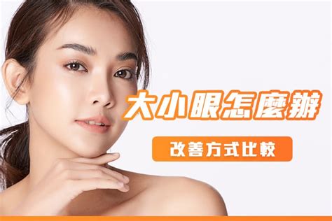 有大小眼怎麼辦？4個大小眼原因及手術改善看這篇！ 維美醫學整形外科診所