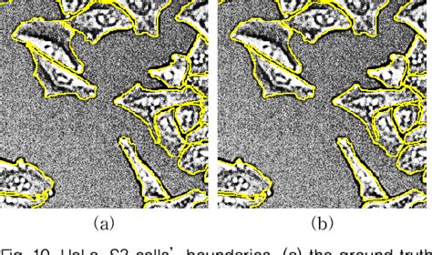 Figure 1 From Bio Cell Image Segmentation Based On Deep Learning Using Denoising Autoencoder And