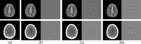 Figure From Optimized Multimodal Neurological Image Fusion Based On Low Rank Texture Prior