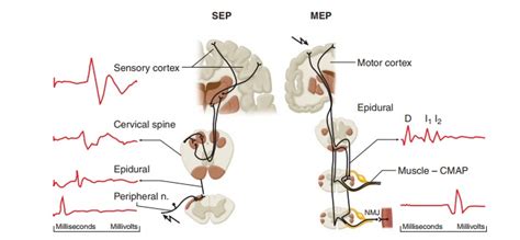 Evoked Potentials Neurological System Monitors