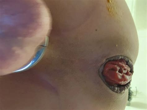 My Gaping Hole Nude Pics Xhamster