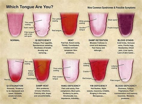 What Is Tongue Diagnosis