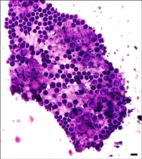 Blepharitis Due To Cryptococcus Neoformans In A Cat From Northern Portugal