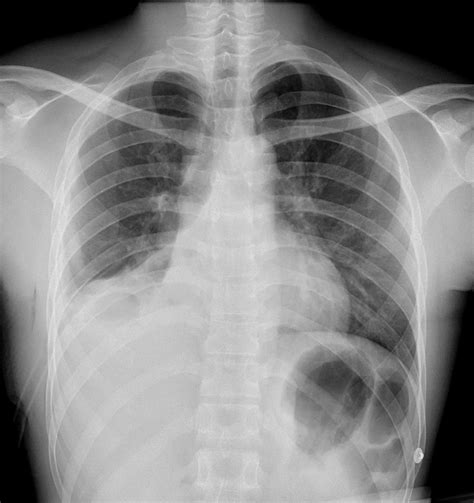 Test 1 Object Detection Model By Test