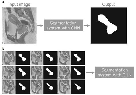a schematic illustration of the system for segmenting a uterus with a download scientific