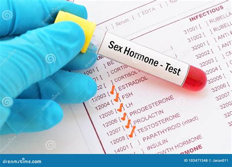 Sex Hormone Test Stock Photo Image Of Follicle Medical