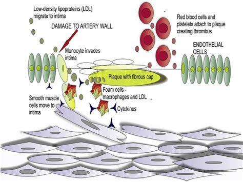 Histological Cross Section Through An Artery Illustrating The Intima Download Scientific