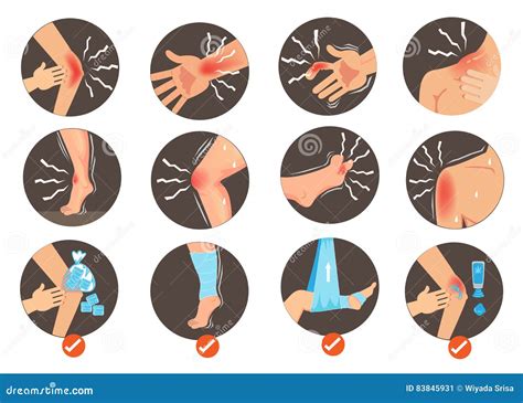 Sprains Stock Vector Illustration Of Elbow Parts Bandaging 83845931