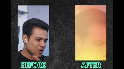 Video Mehul Anand On Linkedin Beforeafterreel