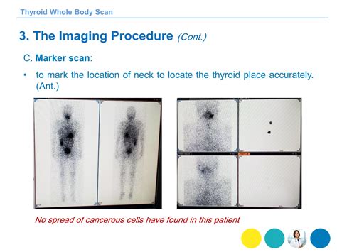 Thyroid Whole Body Scan Pdf
