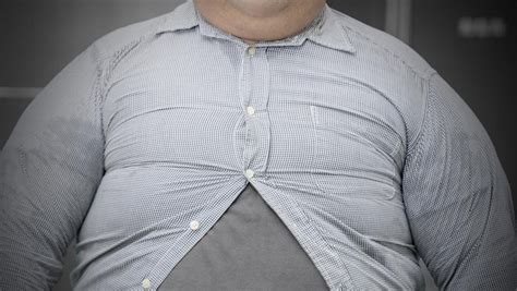 Sulut Juara 1 Kasus Obesitas Di Ri Kemenkes Beberkan Kemungkinan Pemicunya