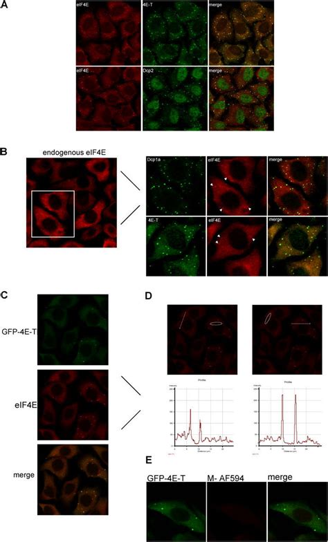 Eif4e Colocalizes With 4e T Dcp1a And Dcp2 In P Bodies A Hela Download Scientific Diagram