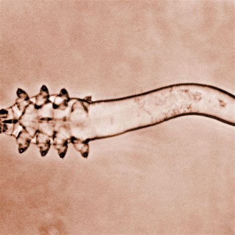 Microscopic Bugs On Body