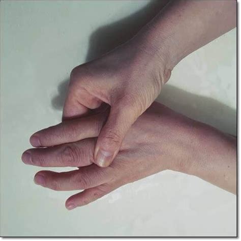 손가락 마디 통증 원인 및 증상과 치료