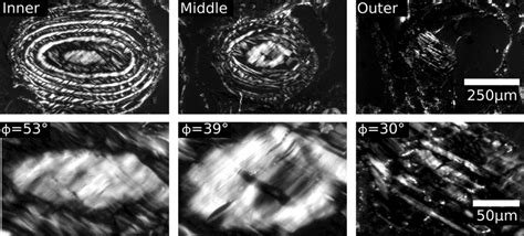 Representative Tangential Micrographs From Inner Middle And Outer Af Download Scientific