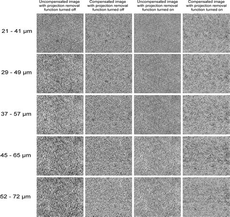 Swept Source Optical Coherence Tomography Angiography Imagin Retina