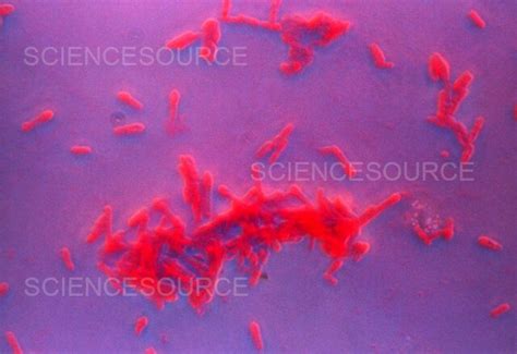 Photograph Lm Of Clostridium Botulinum Bacteria Science Source Images