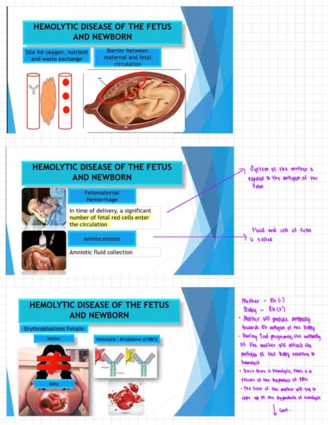 Hdfn Gives Insight On The Hdfn Disease And How To Diagnose Them System Ofthe Mother Is