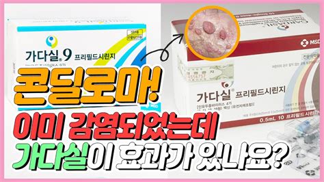 콘딜로마 성기사마귀 가 생겼다면 가다실을 맞아도 되나요 Youtube