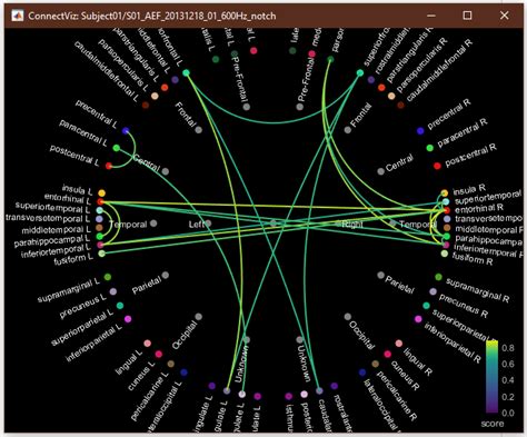 Tutorialsconnectivitygraph Brainstorm