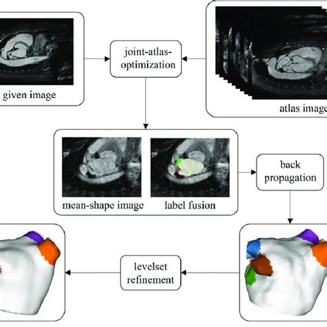 The Diagram Of The Proposed Segmentation Workflow Including