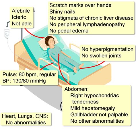 Primary Biliary Cholangitis Interactive Case Study Clinical Odyssey