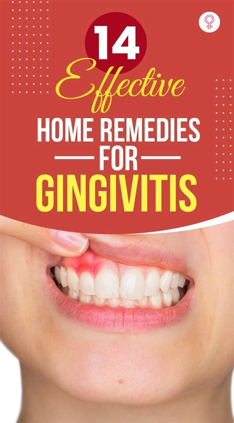 14 Effective Home Remedies To Get Rid Of Gingivitis Artofit