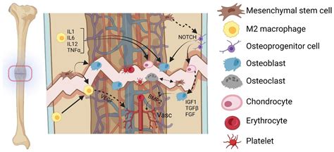 Bioengineering Free Full Text Bone Healing Gone Wrong Pathological Fracture Healing And Non
