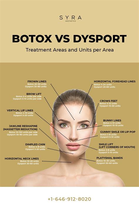 Botox Vs Dysport Dysport Dosing Chart Face Glabellar Lines How Many