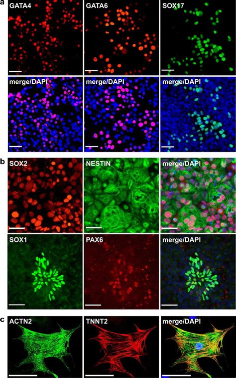 Three Germ Layer Differentiation Potential Of Nwr Ipscs See Also Download Scientific Diagram