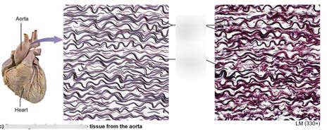 Dense Regular Elastic Connective Tissue Diagram Quizlet