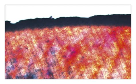 Polarized Light Micrograph Plm At X10 Of Enamel A Enamel After