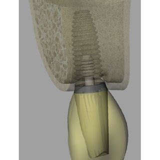 Solid Modeling And Generated Mesh Samples Of All Structures A Download Scientific Diagram