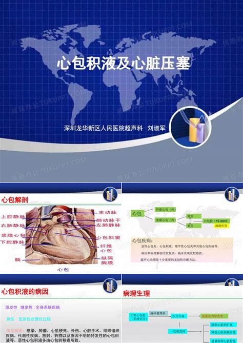 心包积液及心包填塞 图文 PPT模板下载 编号lzgjenea 熊猫办公