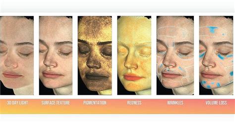 Saar Wollach On Linkedin הדמיית טיפול קוסמטי היישר מכף ידכם