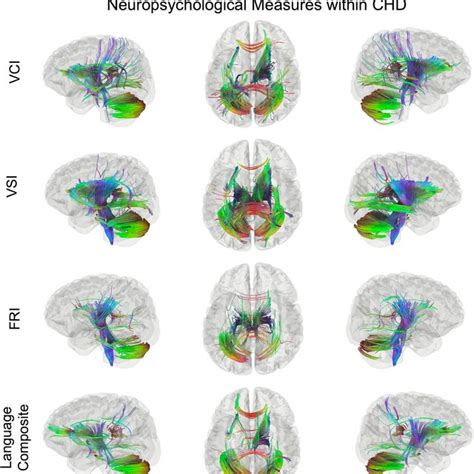 Tracks Where Tpc Chd While Controlling For Sex This Contains Much Of