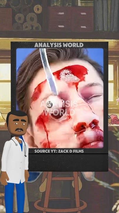 Breathing Tube Inserted Trough Eye 😩 Shorts Youtube