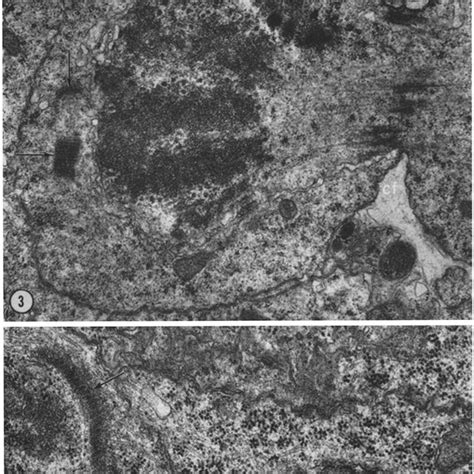 Three Spermatogonial Centrioles Arrows The Pair Of Centrioles At The
