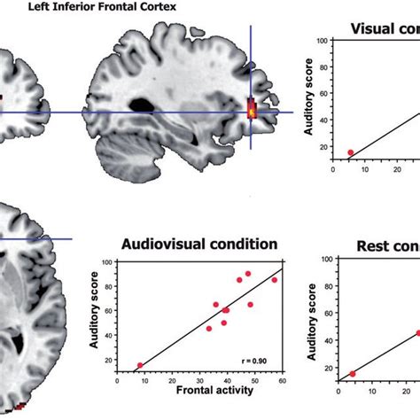 The Frontal Cortex Activity As Shown In The Regression Analysis With Download Scientific