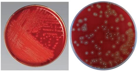 Streptococcus Selective Agar Composition Principle Preparation