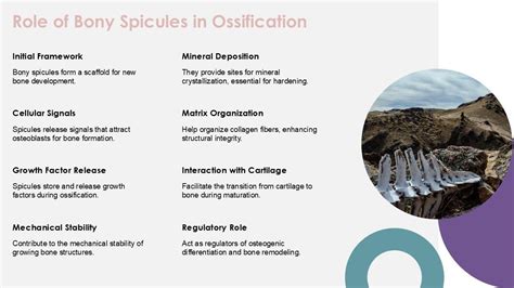 Endochondral Ossification Bony Spicules Ppt Graphics Acp Ppt Presentation
